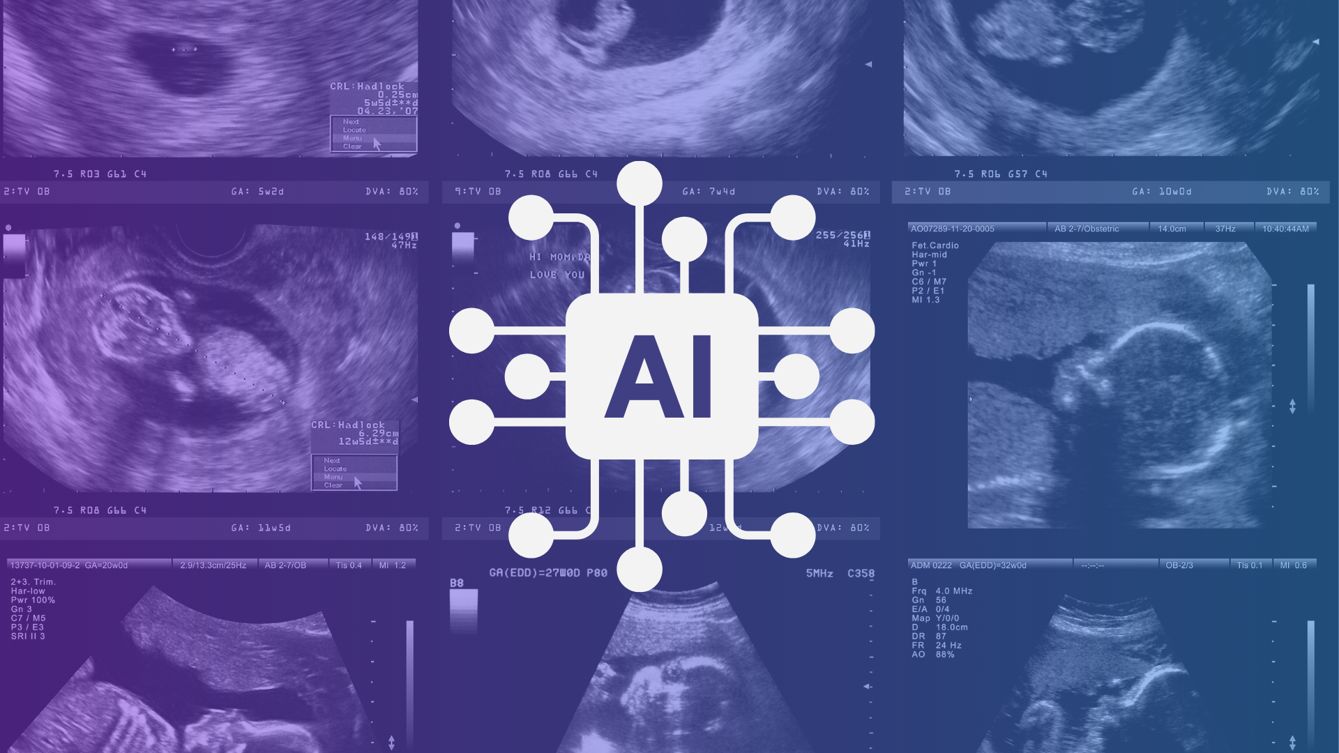 Ai In Ultrasound Reporting Driving Efficiency And Automation As Software